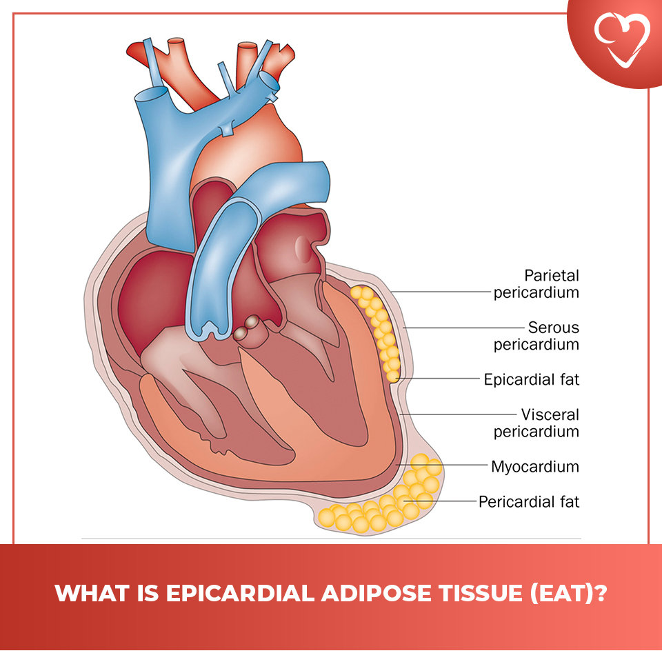 What Is Epicardial Adipose Tissue EAT CardioVisual Heart And